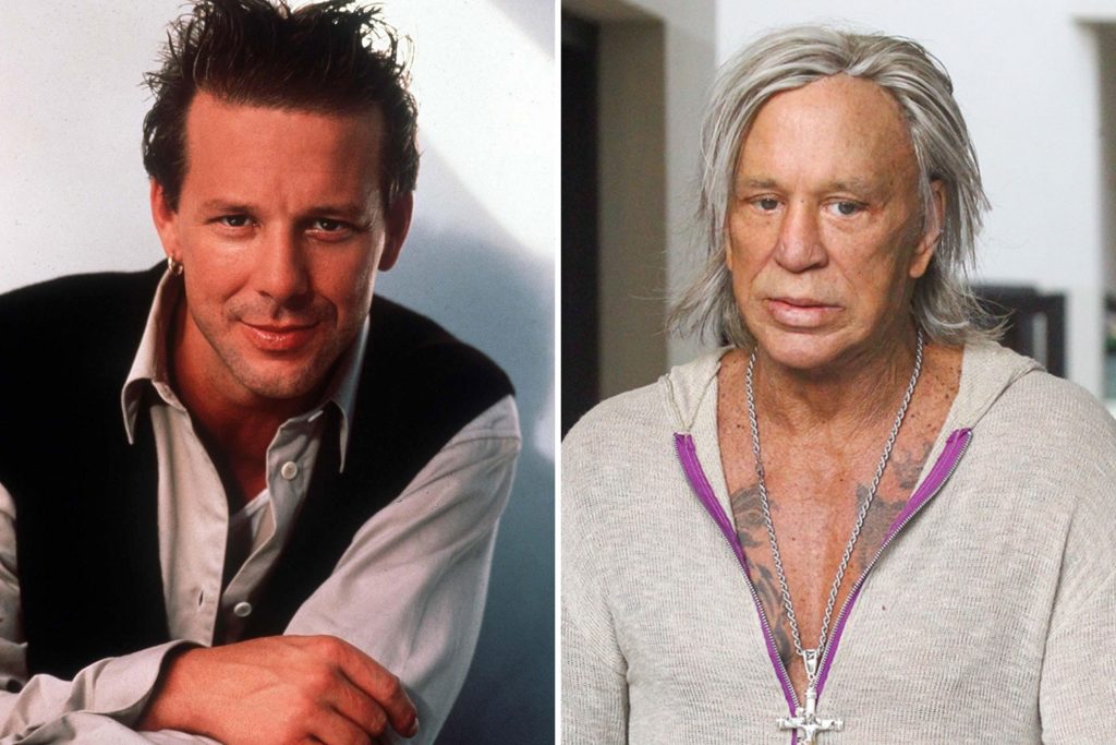Mickey Rourke : Les chirurgies esthétiques qu'il a subi
