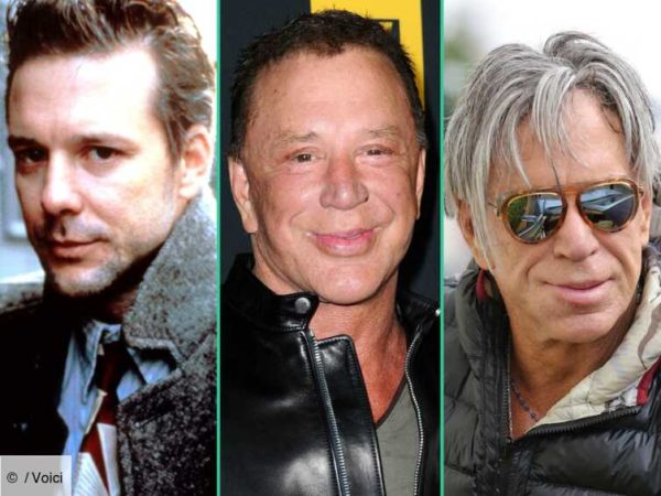 Mickey Rourke : Les chirurgies esthétiques qu'il a subi