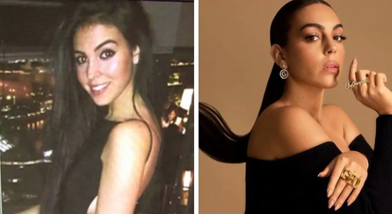 Georgina Rodriguez et sa relation avec la chirurgie esthétique